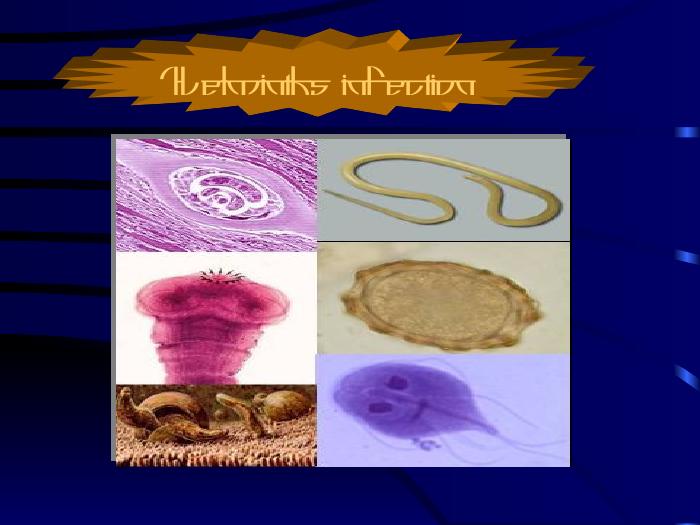 ایران فایلز | پاورپوینت انگل ها و بیماری زایی آنها